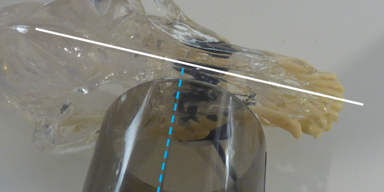 Dental X-ray Positioning Guide Canine Maxillary Premolar 108 – DAVID