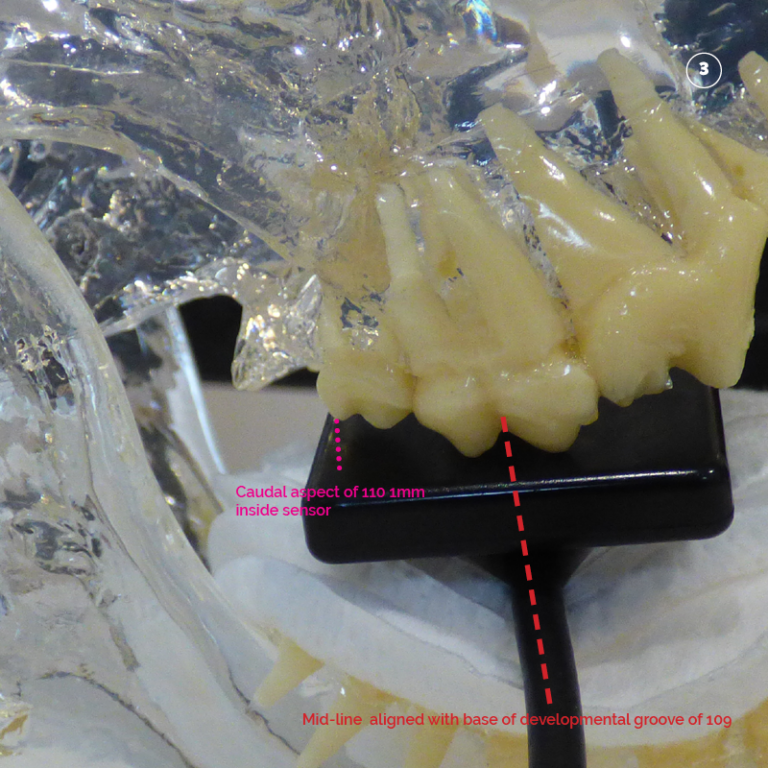 Dental X-ray positioning guide: Maxillary Molars 109 and 110 – D.A.V.I ...